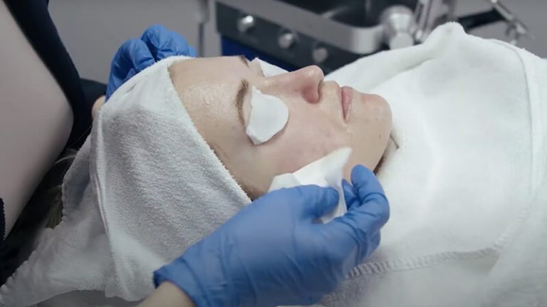 Rain Facial Bellevue and Kirkland